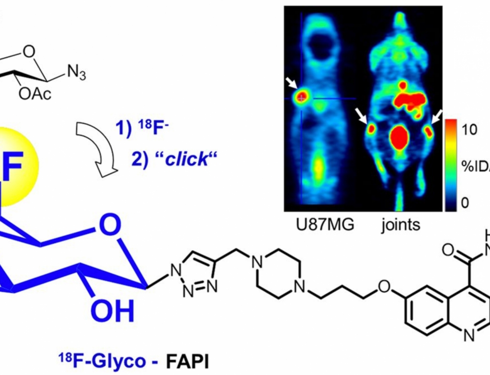Fibroblast Activation Protein-Targeted PET/CT with 68 Ga-FAPI for ...