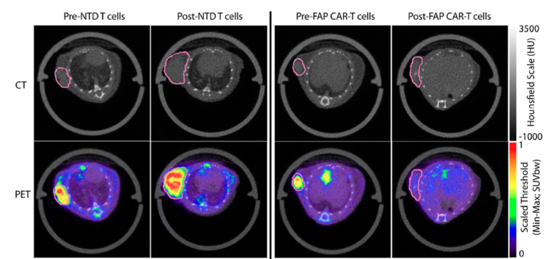 Monitoring Therapeutic Response to Anti-Fibroblast Activation Protein ...