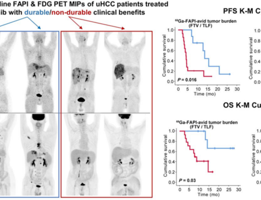 Head-to-Head Intra-Individual Comparison of Biodistribution and Tumor ...