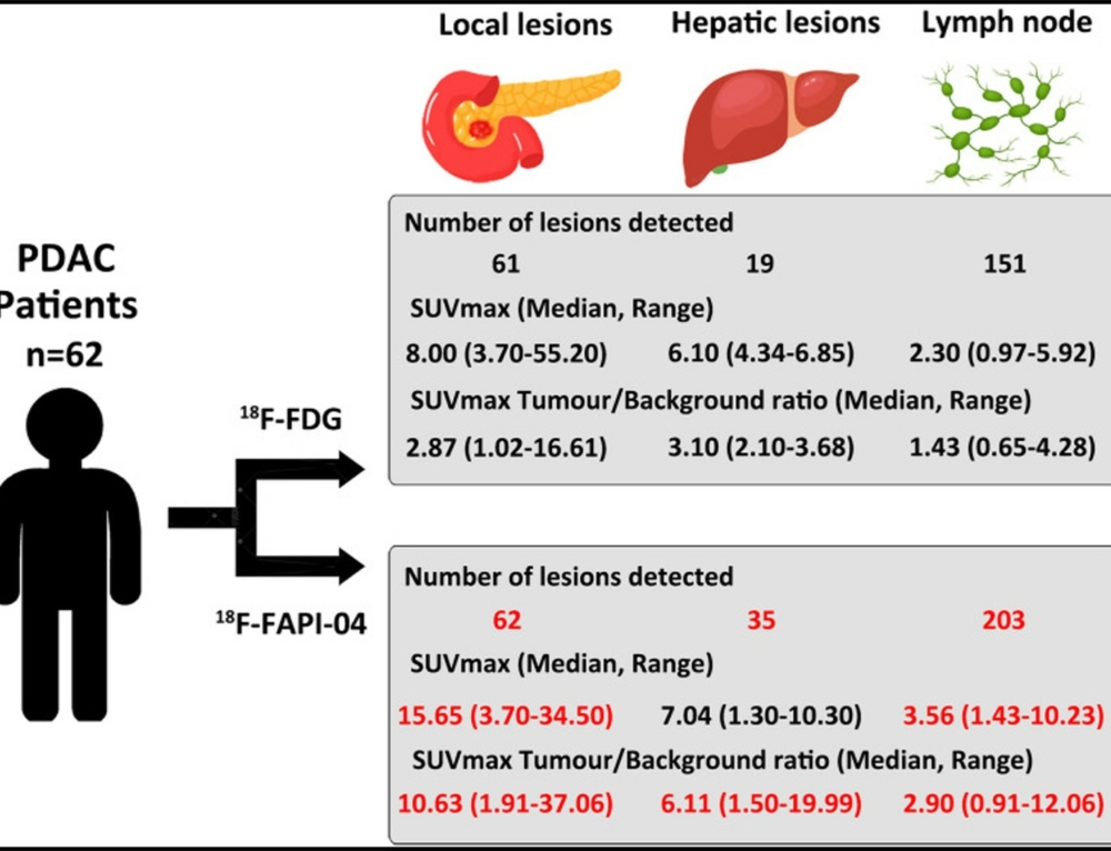 FAPI PET: Fibroblast Activation Protein Inhibitor Use in Oncologic and ...