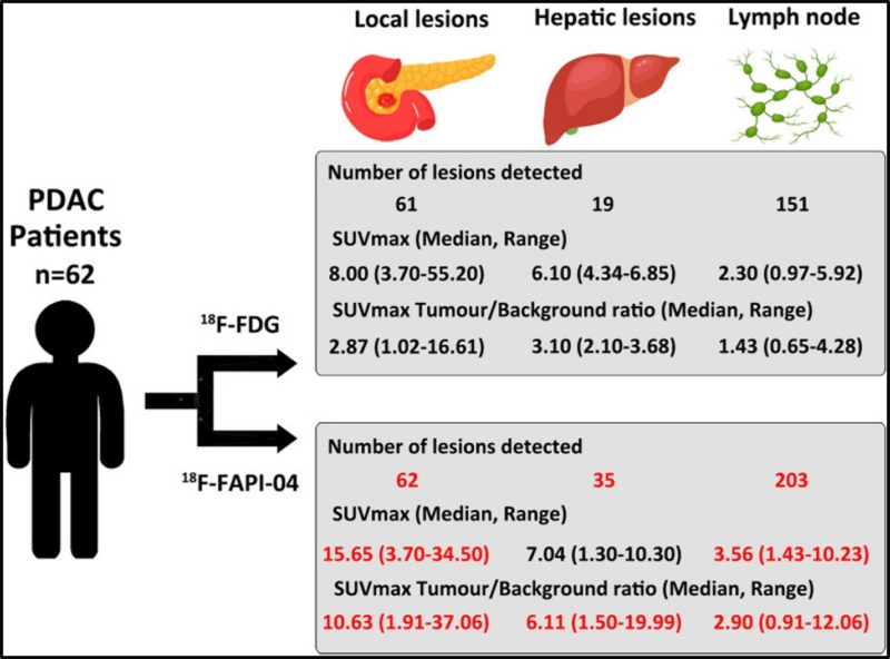 18F-FAPI-04 Outperforms 18F-FDG PET/CT in Clinical Assessments of Patients with Pancreatic ...
